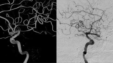 Cases discussions about neuroradiology and neurosurgery