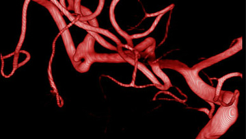 Cases discussions about neuroradiology and neurosurgery