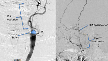 Cases discussions about neuroradiology and neurosurgery