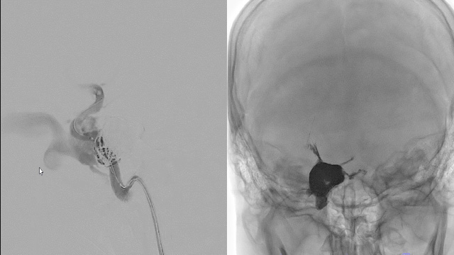Cases discussions about neuroradiology and neurosurgery