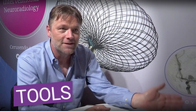 Cerus Endovascular Receives FDA Breakthrough Device Designation for its ...